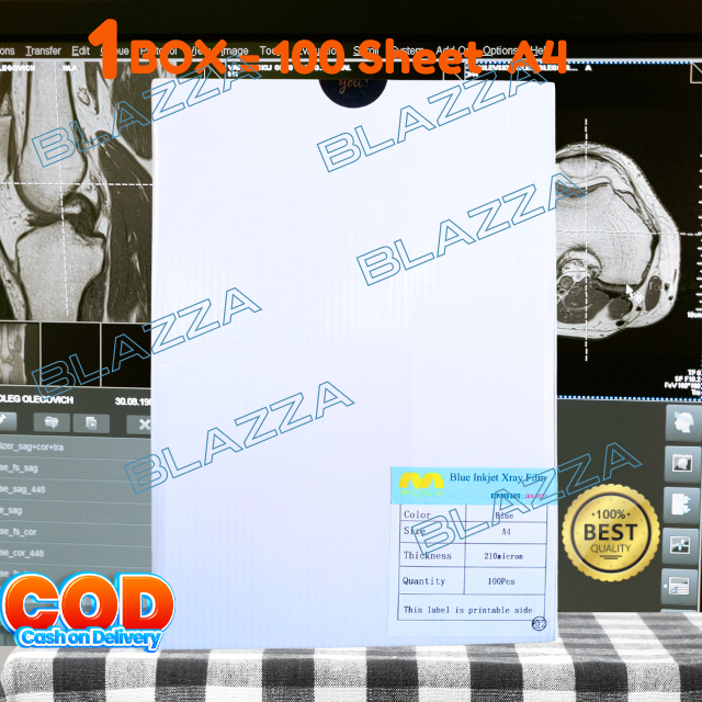 Jual Medical Dry Film Inkjet Digital MCU Radiology DR CR Rontgen X-Ray ...