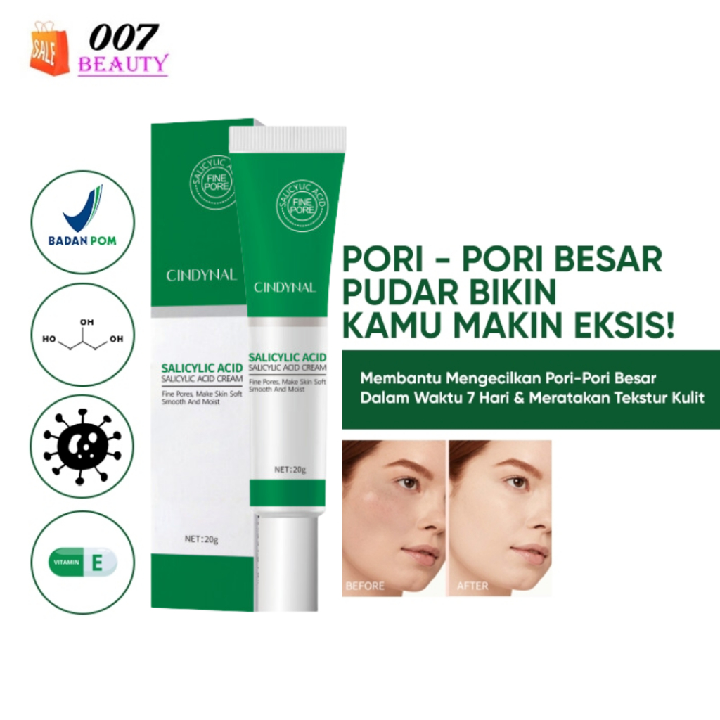 Jual BPOM CINDYNAL Cream Pori Wajah /Jerawat Salicylic Acid 20ml | Shopee Indonesia