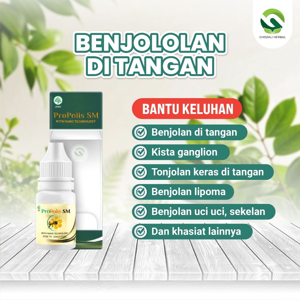 Jual Obat Benjolan Di Tangan, Kista Ganglion, Penghilang Benjolan Di ...