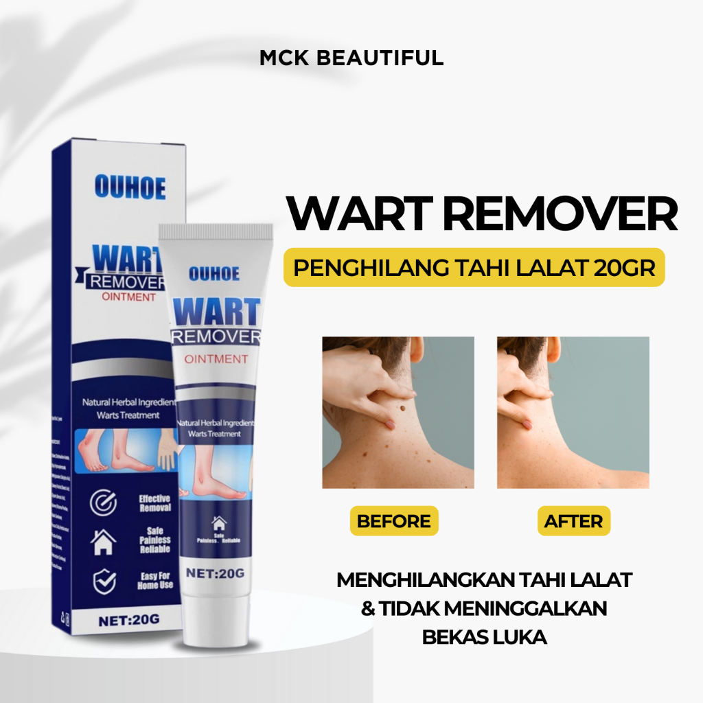 Jual PENGHILANG KUTIL TAHI LALAT MATA IKAN SKIN TAG REMOVER ASLI ...