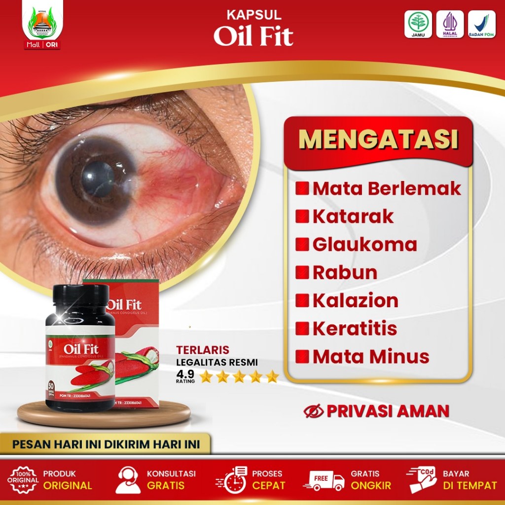 Jual Obat Mata Berlemak Pterigium, Glaukoma, Katarak, Rabun, Kalazion ...