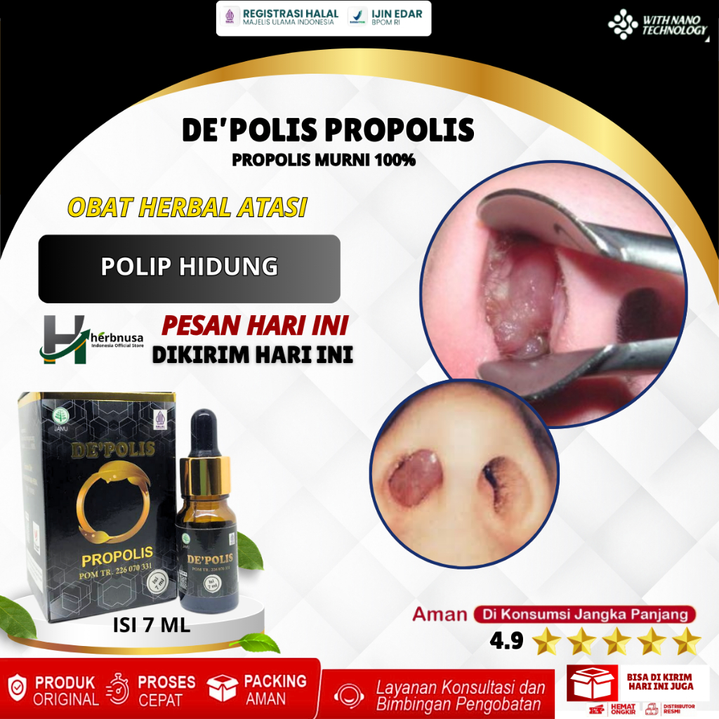 Jual Obat Polip Hidung, Obat Polip Hidung Semprot, Polip Hidung Untuk Dewasa & Anak Anak, Obat ...