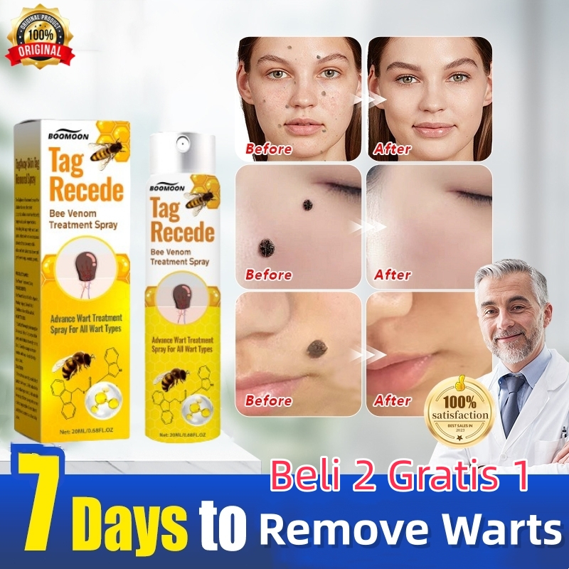 Jual Penghilang tahi lalat di wajah Penghilang kutil di leher Wart ...