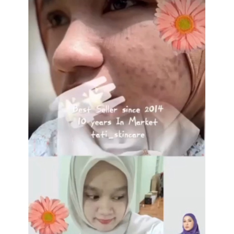 Jual BEST PAKET KRIM CREAM TATI SKINCARE ORIGINAL PAKETAN ECER UV DAY ...