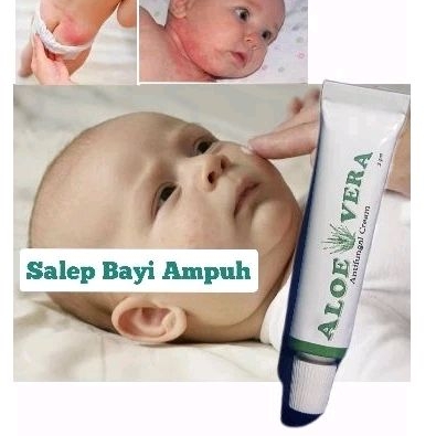Jual Sapep Aloevera Bayi Antifungal cream Ampuh mengatasi Kulit gatal ...