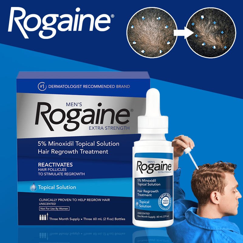 Jual Men's Rogaine 5% Minoxidil Topical Solution 60ml | Shopee Indonesia