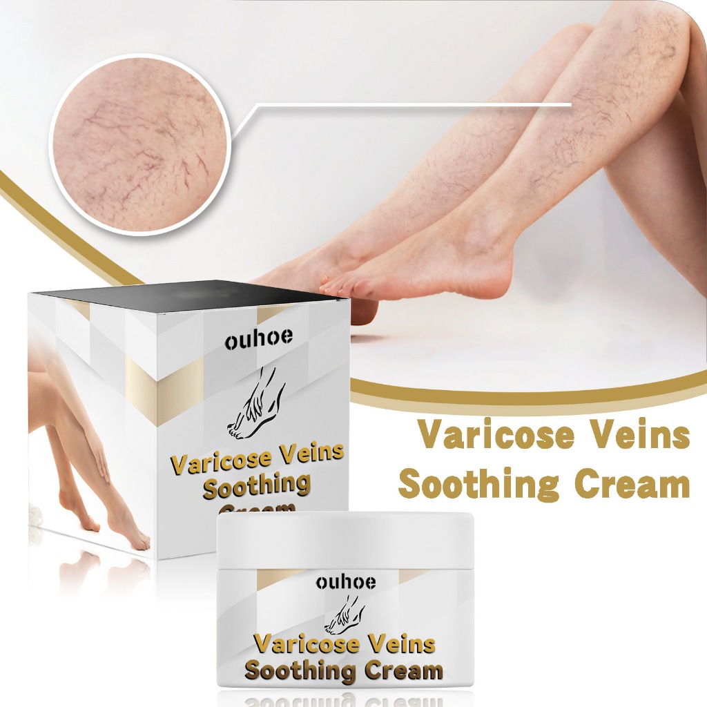 Jual Relief Phlebitis Cream Eliminating Vasculitis Soothing Earthworm ...