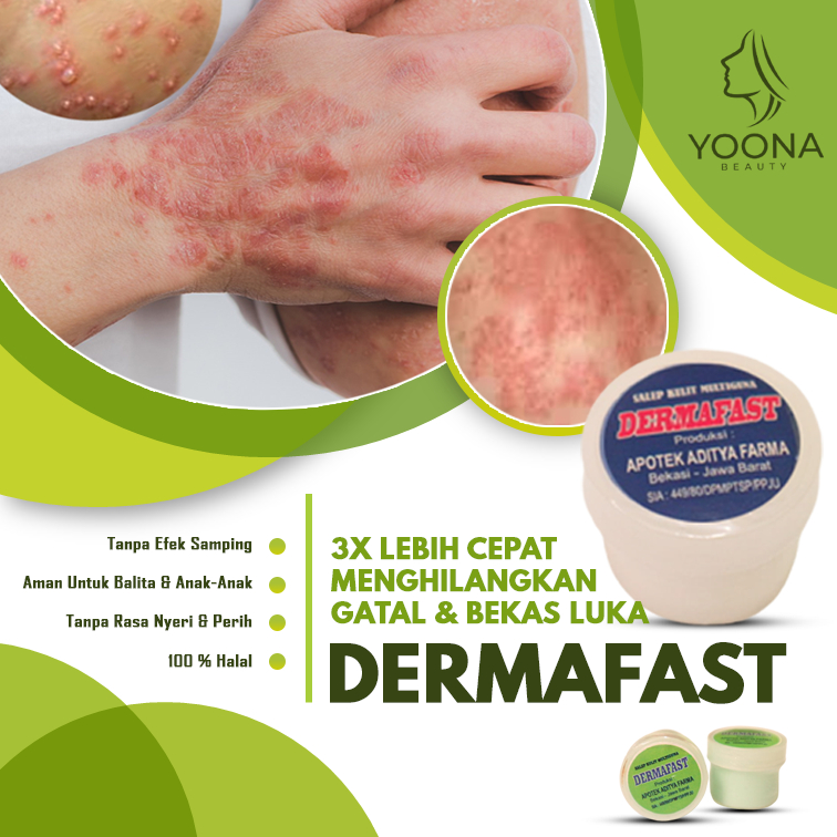 Jual Salep Obat Gatal Panu Eksim Kurap Bisul Paling Cepat DERMAFAST ...