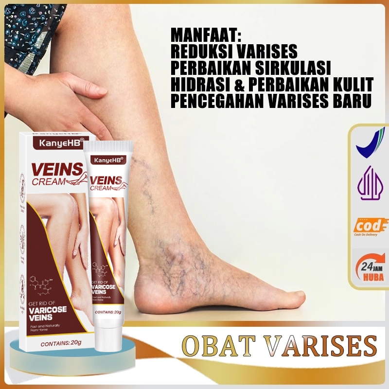 Jual varicose veins cream varicose veins effective remover 20g obat ...