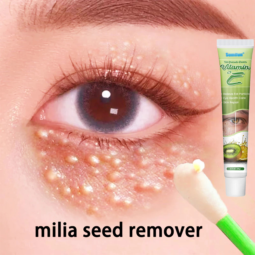 Jual Vitamin E Eye Cream Anti Aging menghilangkan milia menghilangkan ...