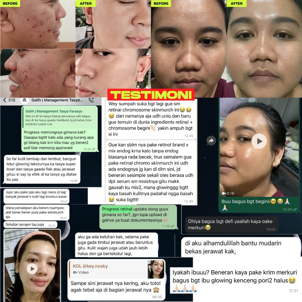 Jual SKINMURCH MATC BOOSTING Retinal Chroma Version - Fast Track Glass ...