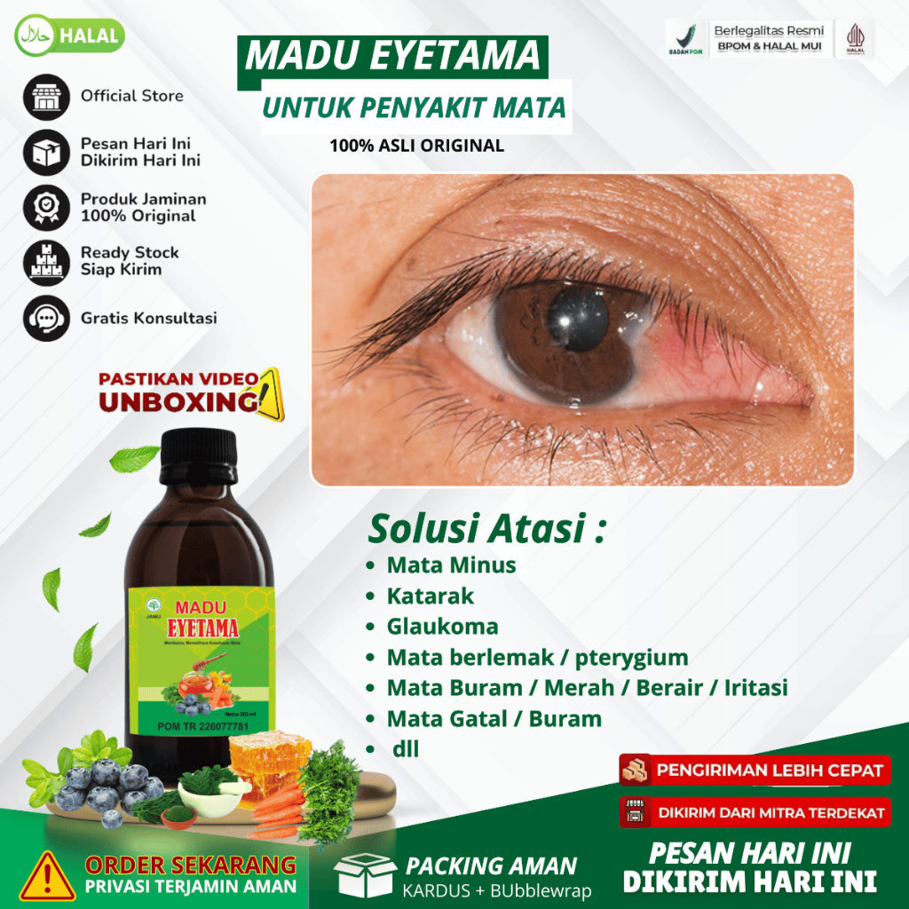 Jual Obat Mata Berlemak,Pterygium,Menghilangkan Selaput Mata, Penghilang Lamad Di Selaput Putih ...
