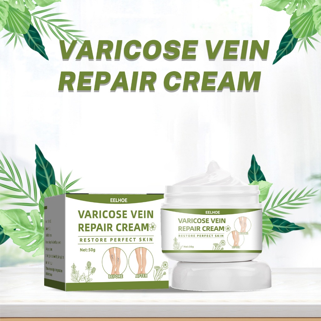Jual Obat Salep Varises 50g Varicose Veins Cream Effective Relieves Leg ...