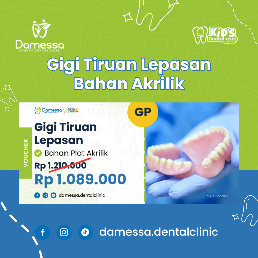Jual Voucher Pasang Gigi Tiruan Damessa - Bahan Plat Akrilik Dokter Gigi Umum (GP) | Shopee ...