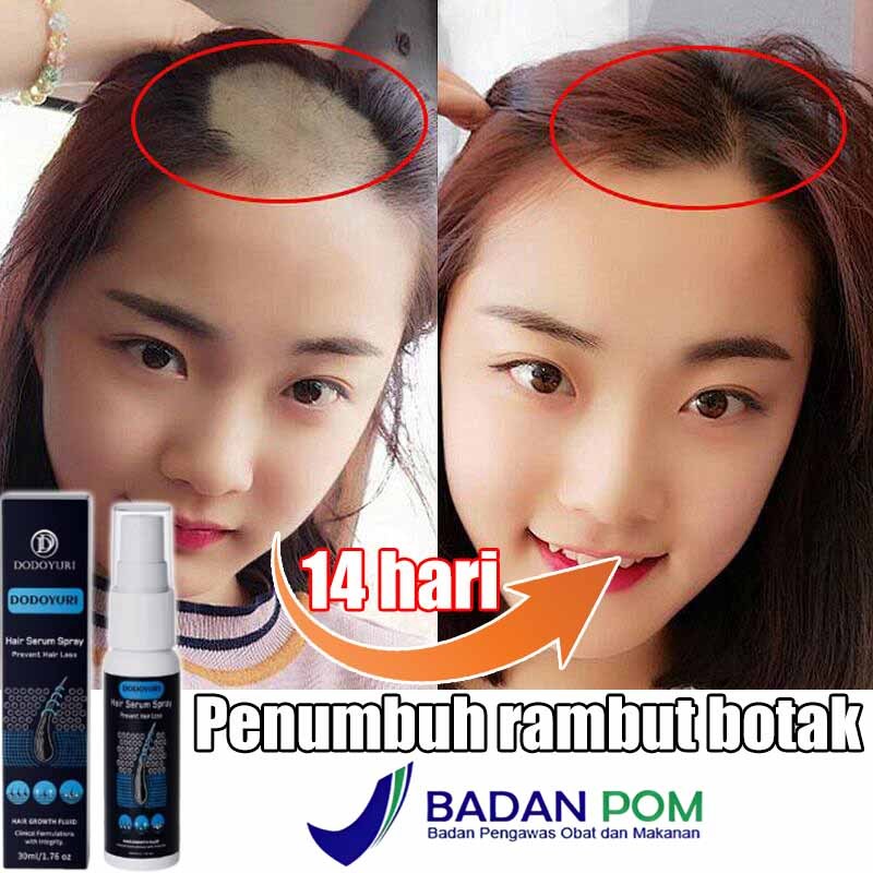 Jual Penumbuh rambut botak Serum penumbuh rambut Obat penumbuh rambut ...