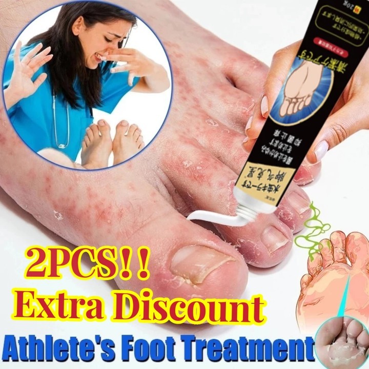 Jual Beriberi Antibacterial Cream 20g Menghilangkan Jamur Tinea Pedis ...