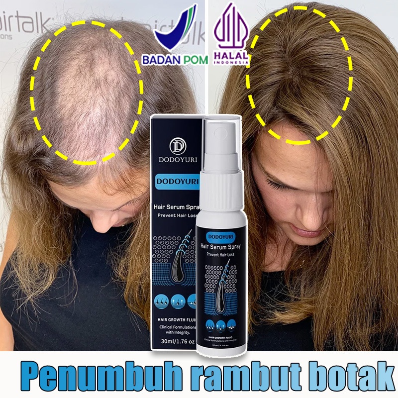 Jual Penumbuh rambut botak Penumbuh rambut cepat obat penumbuh rambut ...