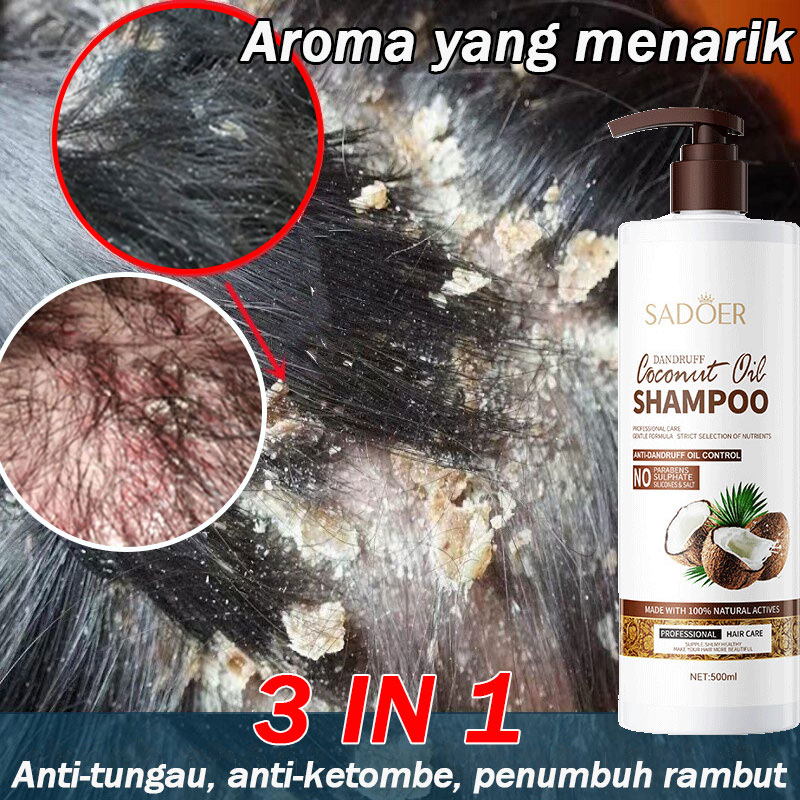 Jual Shampo anti ketombe Coconut shampo Sampo anti gatal dan antiketombe Sampo ketombe parah ...