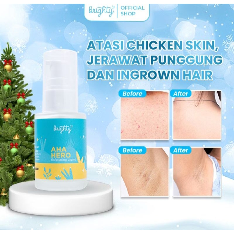 Jual Brighty Aha Hero Exfoliating Liquid Serum Pencerah Ketiak Jerawat ...