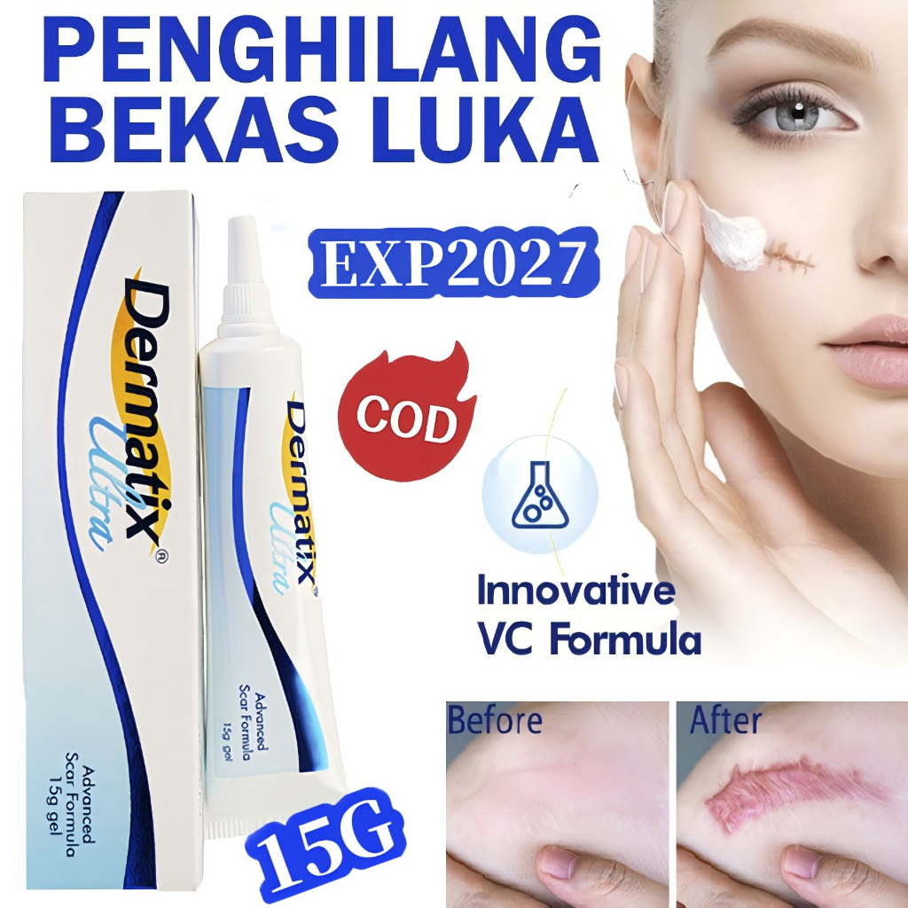 Jual [BEST SELLER] Dermatix Ultra Salep Cream 15g Remove Keloid ...