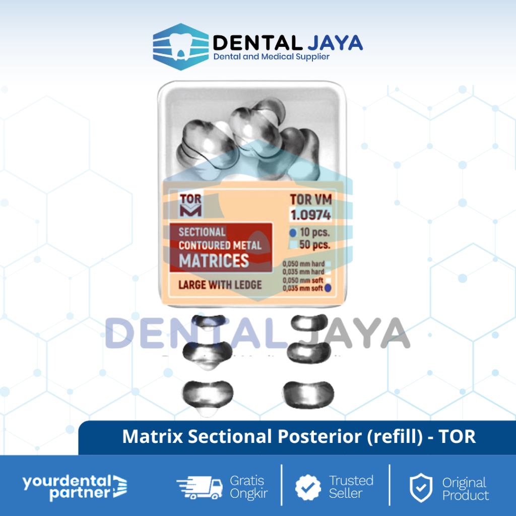 Jual TOR Matrix Sectional Posterior Refill | Shopee Indonesia