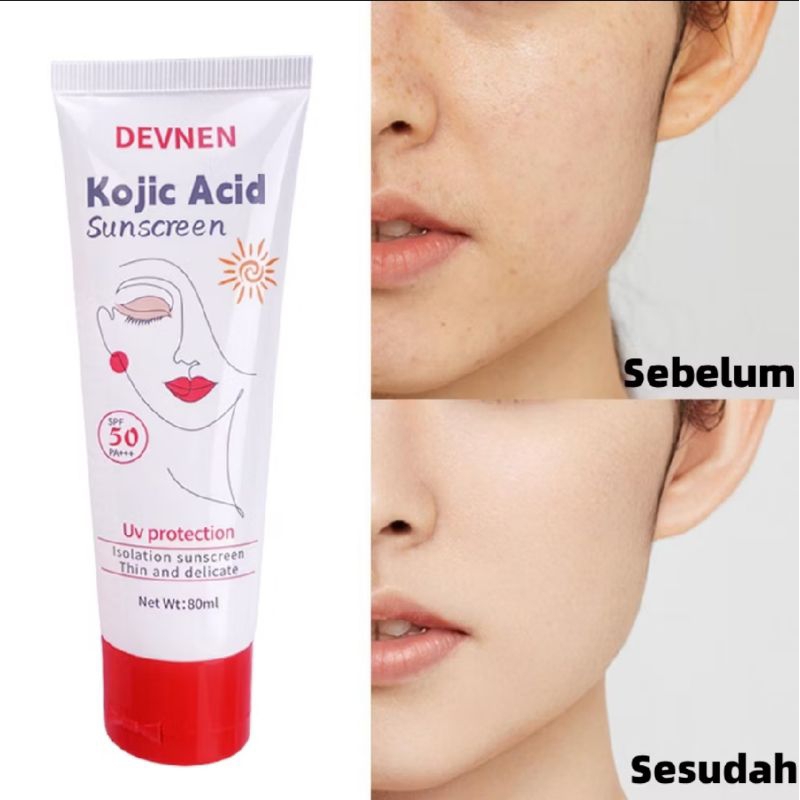 Jual Kojic Acid Sunscreen Lotion SPF 50 PA+++ Sunblock Protection ...