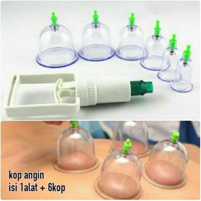 Jual Alat Bekam Lengkap Isi 6 Cup / Kop Angin Untuk Mengobati Masuk Angin Dan Kesehatan Badan ...