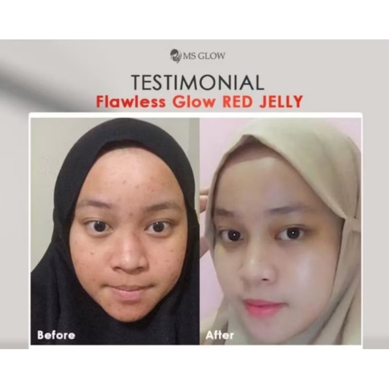 Jual MS Glow Flawless Red Jelly Original | Shopee Indonesia
