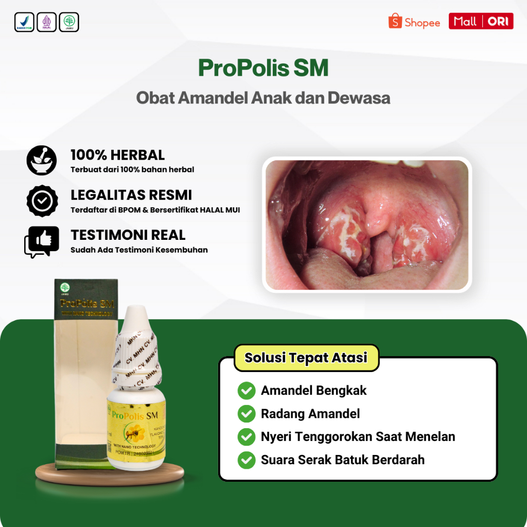 Jual Obat Amandel Anak & Dewasa, Pengempes Amandel Bengkak, Radang Amandel, Nyeri Menelan ...