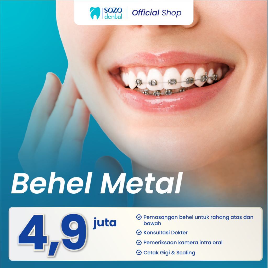 Jual Behel Metal Basic Rahang Atas dan Bawah, termasuk: Basic Scaling, Cetak Gigi, Konsultasi ...