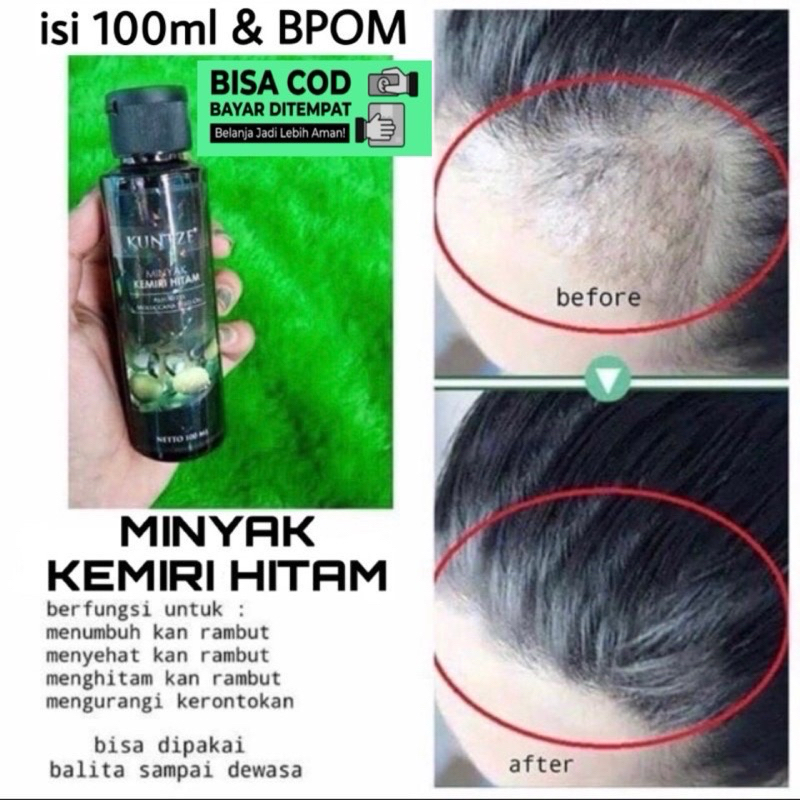 Jual PENUMBUH RAMBUT BOTAK PENUMBUH BREWOK PENUMBUH ALIS CEPAT OBAT ...