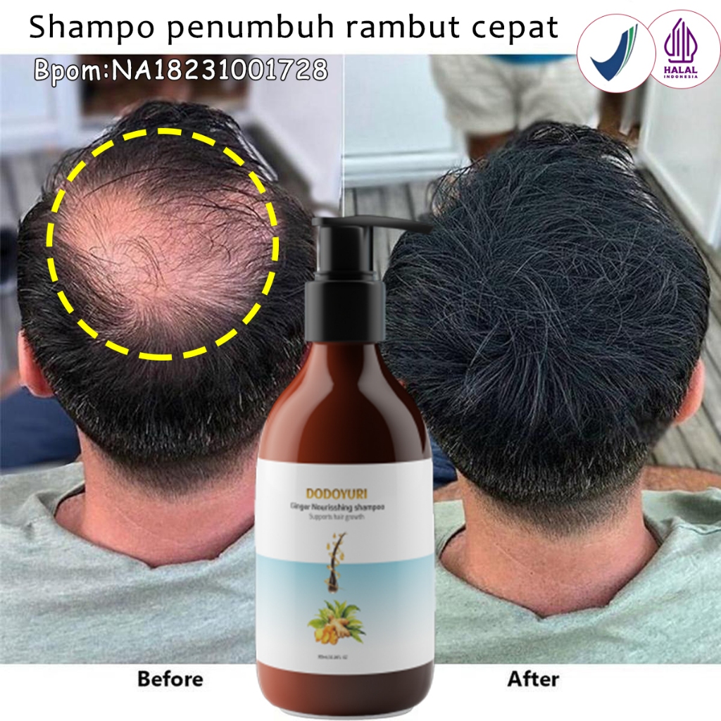 Jual 【BPOM】Shampo penumbuh rambut cepat Shampoo rambut rontok penumbuh ...