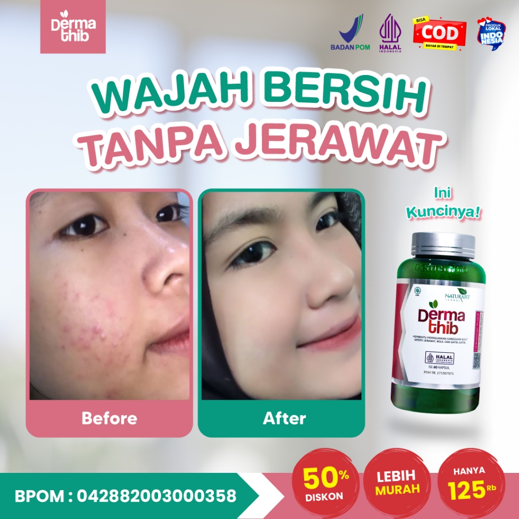 Jual DERMATHIB - Kapsul Derma thib Obat Jerawat & Bekas Jerawat BPOM ...