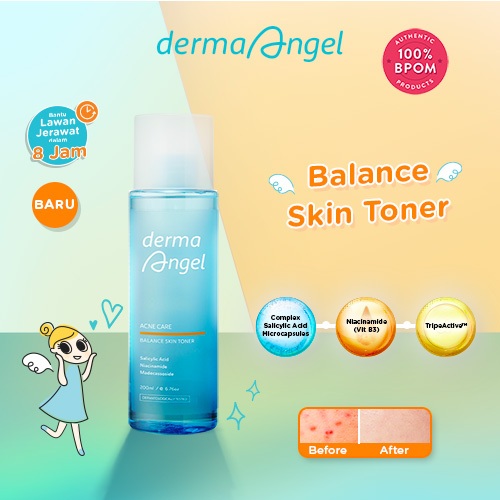 Jual [HOT DISCOUNT 55%] Derma Angel Acne Care Balance Skin Toner ...