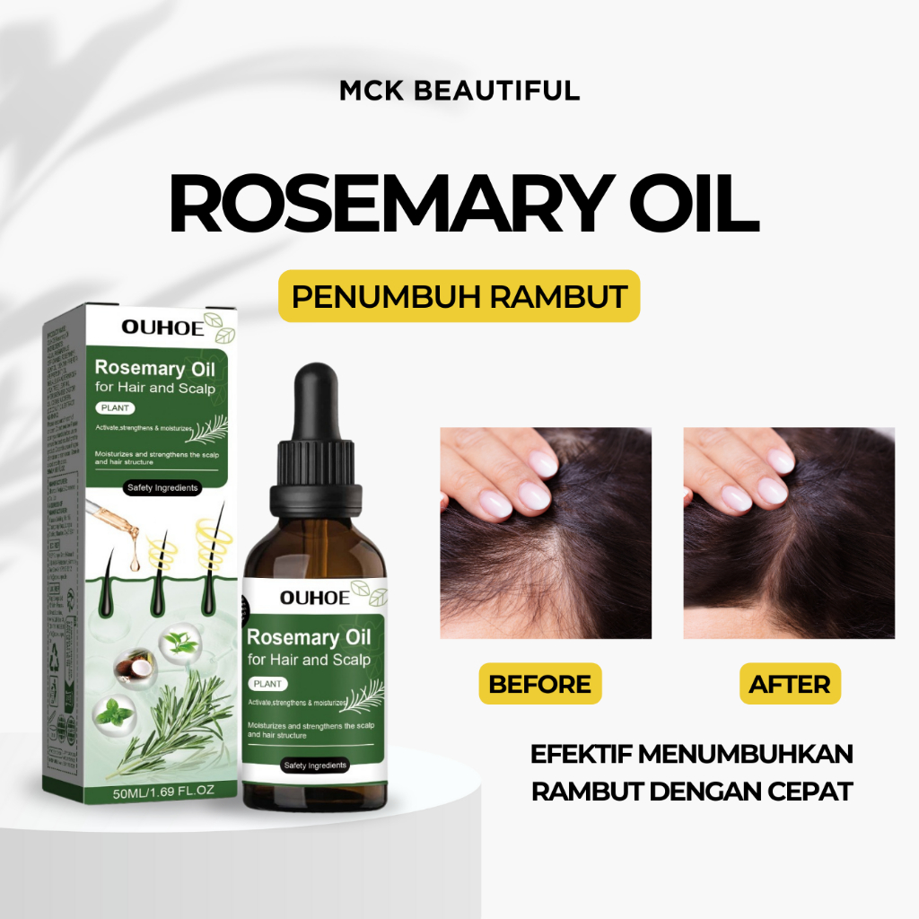 Jual 50ml penumbuh rambut cepat dan tebal serum rambut rontok Hair ...