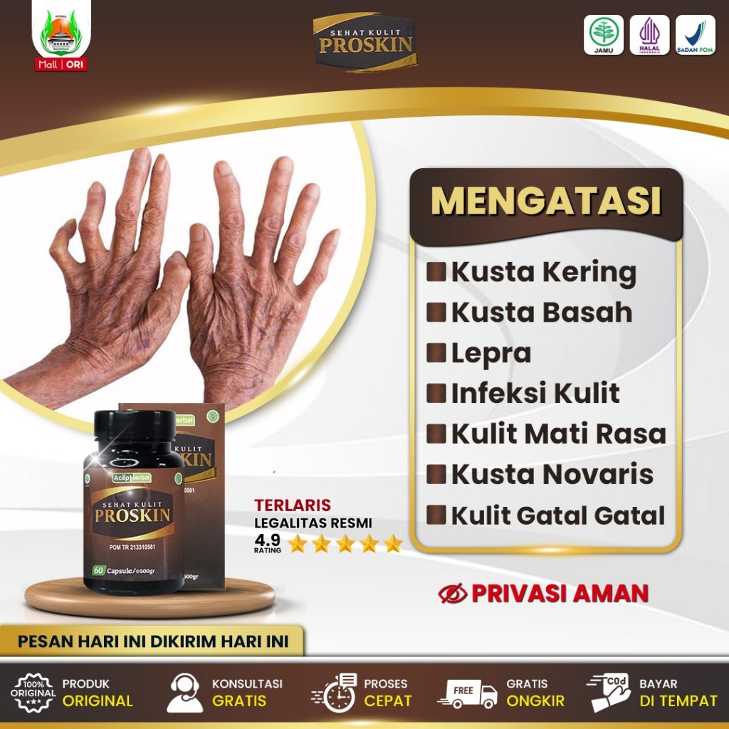 Jual Obat Kusta Kering, Kusta Basah, Lepra, Mati Rasa, Infeksi Kulit ...