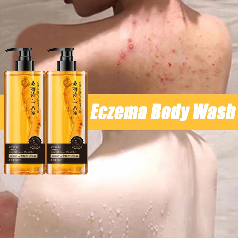 Jual Eczema Body Wash 300ml Acne Body Wash Sabun gatal kulit ampuh Sabun Mandi Belerang Sulfur ...