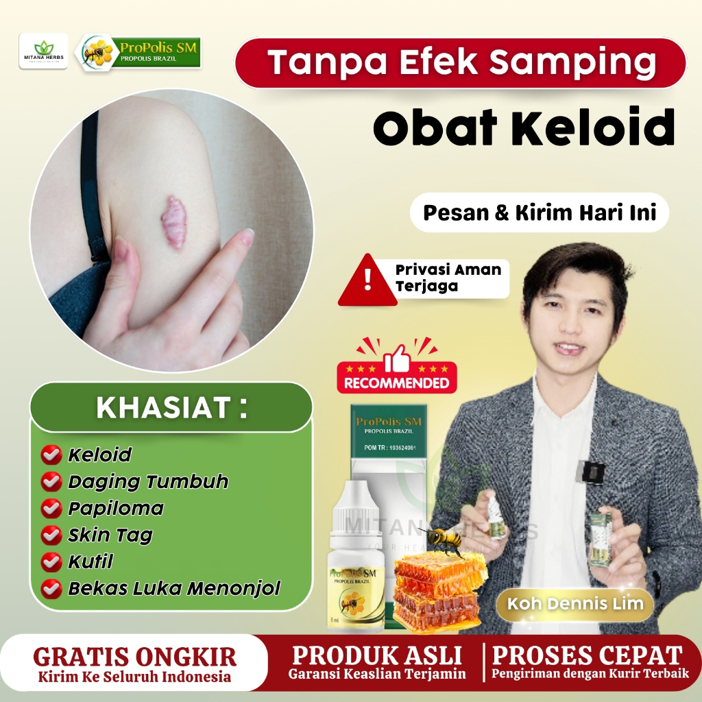 Jual Obat Keloid / Obat Keloid Daging Tumbuh / Obat Keloid Menahun / Obat Penghilang Keloid ...