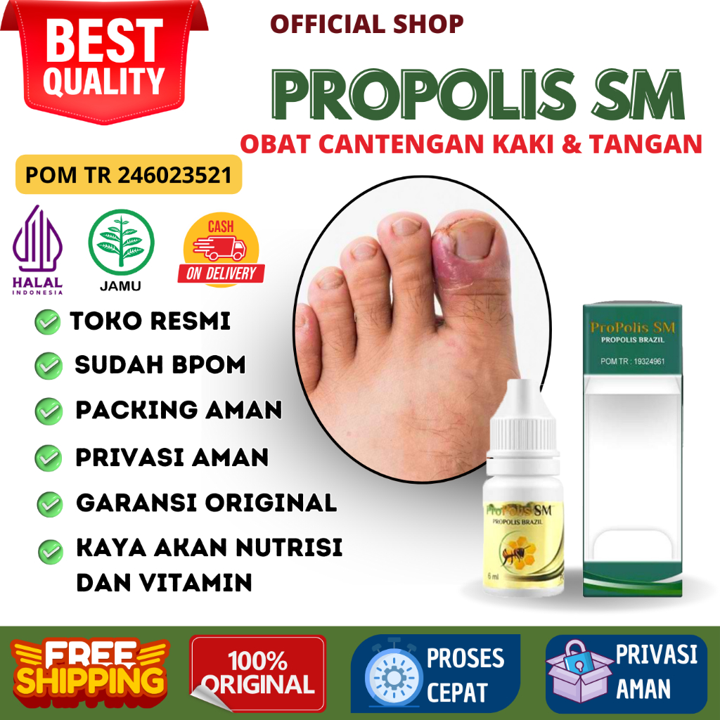 Jual Propolis Sm Brazil Isi 6Ml Original Obat Cantengan Jempol Kaki ...
