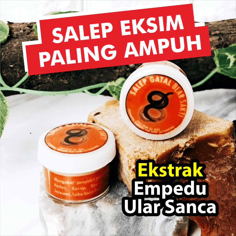 Jual Salep Obat Gatal Kulit Eksim Kering Paling Ampuh Gatel Exim Salap ...