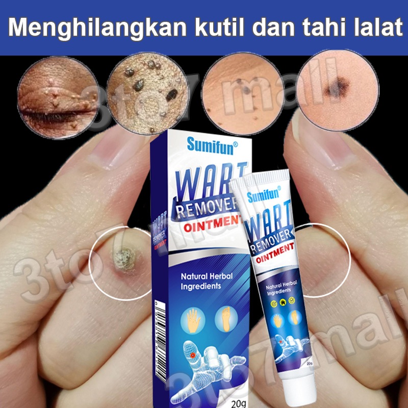 Jual penghilang kutil dan tahi lalat salep kutil paling ampuh wart ...