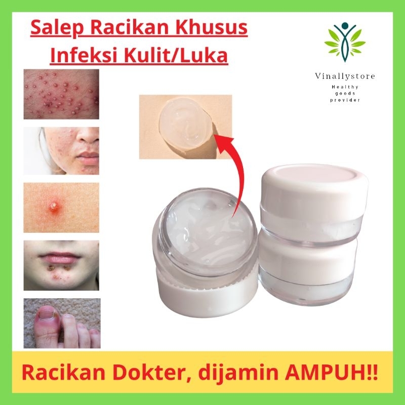 Jual Viroderm Salep Racikan Untuk Infeksi Kulit/Luka (mengobati ...