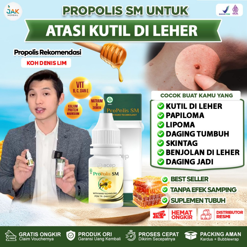 Jual Obat Papiloma Daging Tumbuh Kutil Di Leher Skin Tag Keloid Di ...