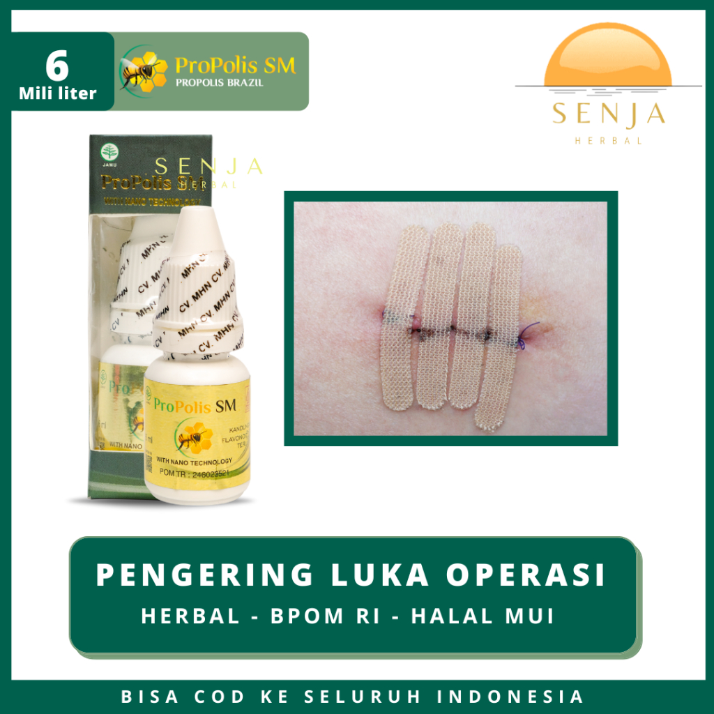 Jual Obat Pengering Luka Bekas Operasi, Caesar, Luka Bernanah ...