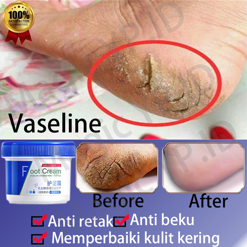 Jual vaseline kaki pecah dan kering penghalus tumit kaki obat kaki ...