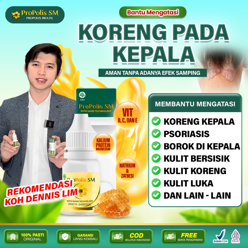 Jual Propolis SM Herbal - Obat Tetes Koreng Di Kepala Psoriasis Borok ...