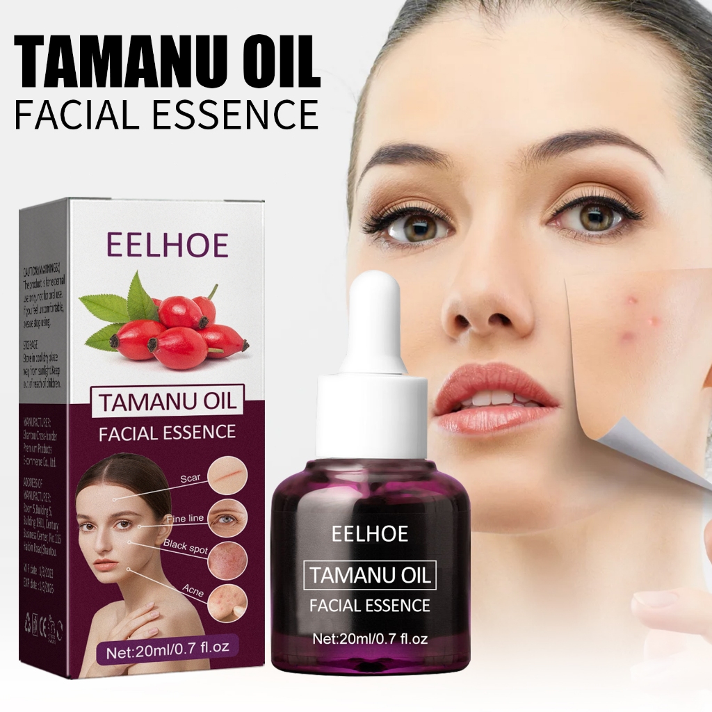 Jual Eelhoe Minyak Tamanu Oil 20ml Menyusutkan Pori-Pori Wajah Dan ...
