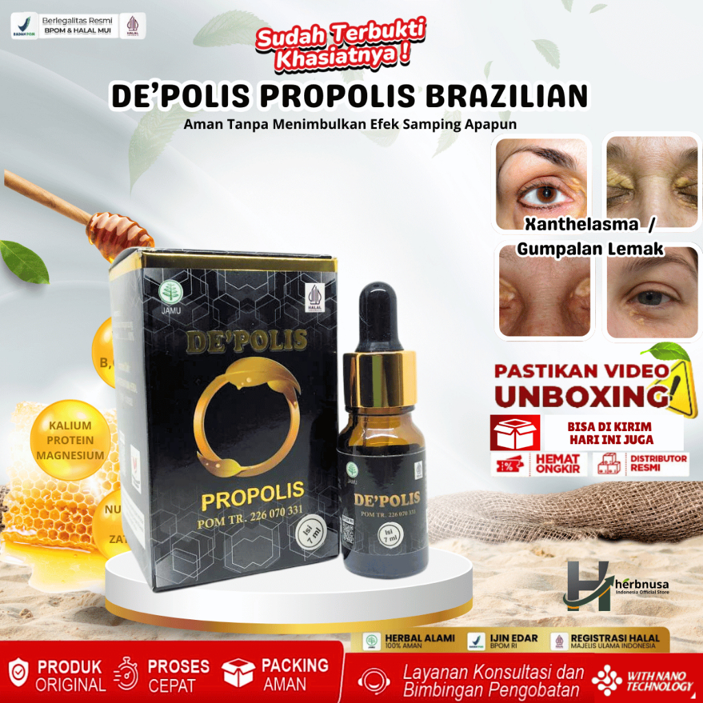 Jual Obat Xanthelasma Flek Kuning Di Mata Gumpalan Lemak Mata Millia ...