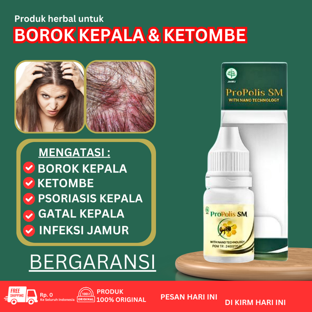 Jual Obat Borok Kepala Bernanah - Psoriasis Kulit Kepala - Kepala Berkerak Ketombe Parah - Jamur ...