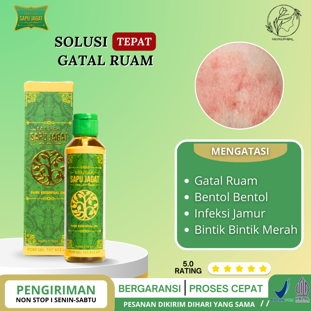 Jual Obat Gatal Ruam Bentol Bentol Infeksi Jamur Gatal Bintik Binti ...